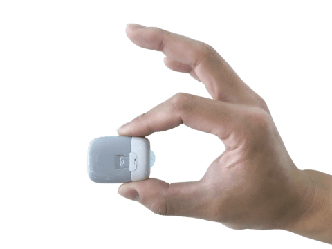 1 an avec la pompe Medtrum : Témoignage de Maud